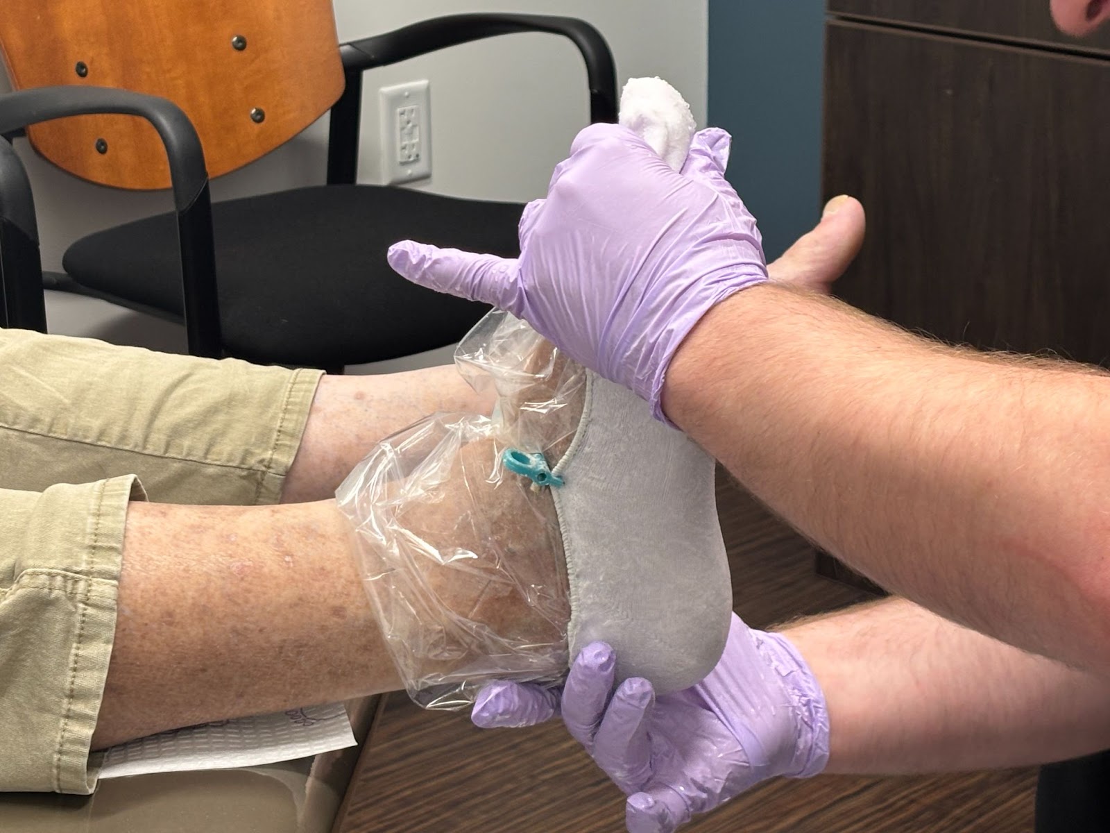 Bunions: Are You Headed for Surgery? - Preferred Foot & Ankle